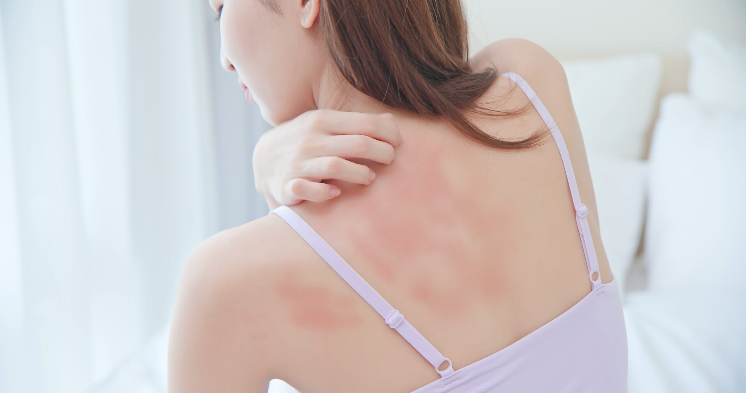 Should I See A Doctor For This Rash West Tennessee Healthcare