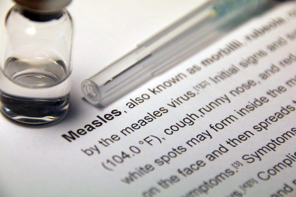 Protecting Yourself Against the Measles If You’re an 80s Baby - West ...